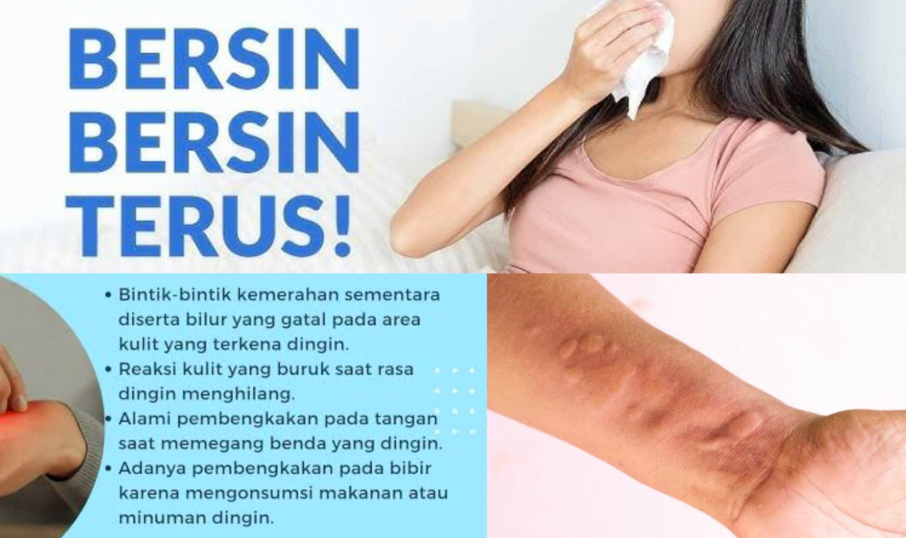 Punya Alergi Dingin dan Debu? Ini Obat dan Cara Mengatasinya